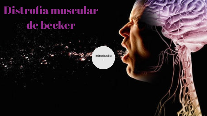 Distrofia muscular de becker by anyela torres on Prezi