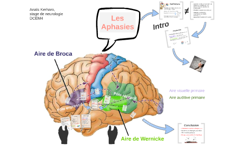Aphasie de Broca by Anaïs Ker on Prezi