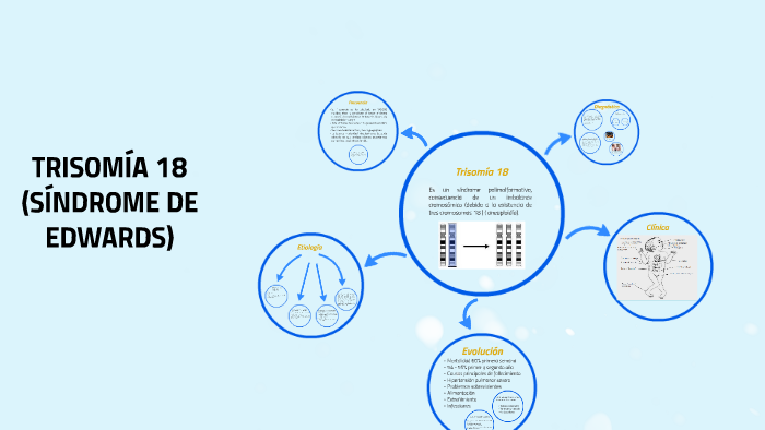 Trisomía 18 by pepe jimenez on Prezi