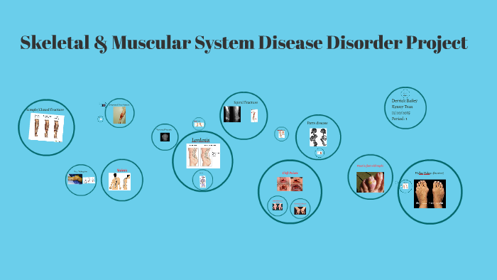 Skeletal & Muscular System Disease Disorder Project by Kenny Tran