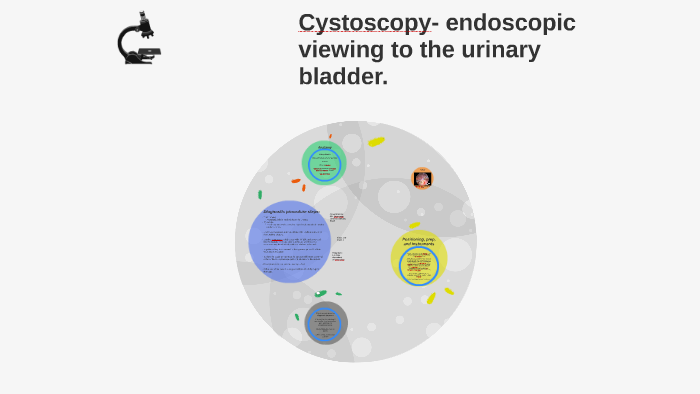 Cystoscopy- endoscopic viewing to the urinary bladder. by Kyle Thomas ...