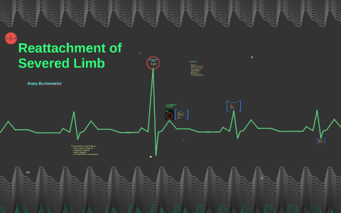 Reattachment of Severed Limb by Anna Bornemeier on Prezi