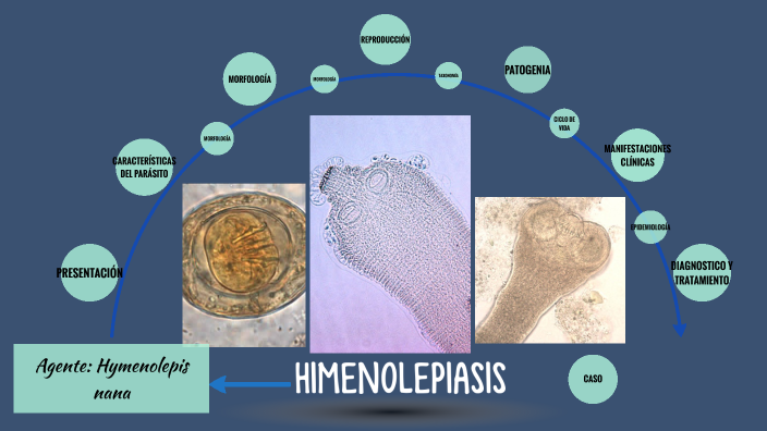 HIMENOLEPIASIS by gina rosales on Prezi