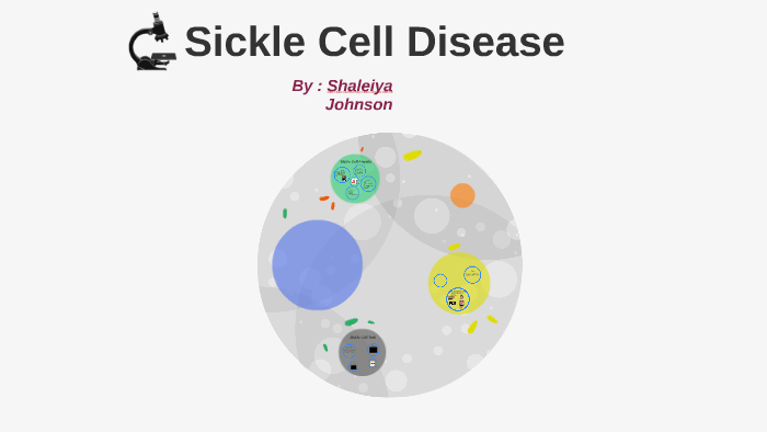 Sickle Cell Anemia/ Trait by sheleia johnson