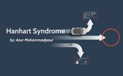 Hanhart Syndrome by Azur Pour on Prezi