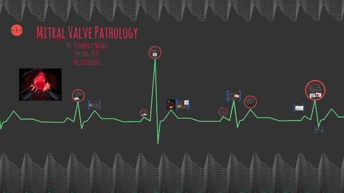Mitral Valve Pathology by Kimberly Maher on Prezi