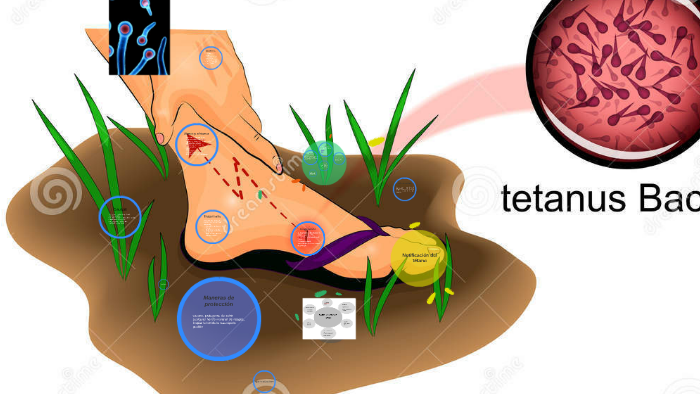 TETANO by Laura Nonato on Prezi