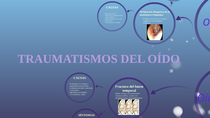 TRAUMATISMOS DEL OÍDO by Lidia Diosdado Masa on Prezi