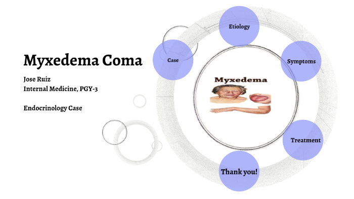 Myxedema Coma by Jose Ruiz on Prezi