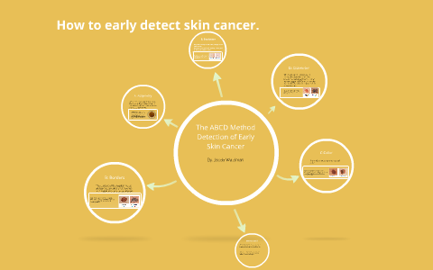 The ABCD Method Detection of Early SKin Cancer by Jacob Waldman on Prezi