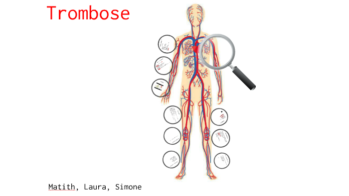Trombose by Simone Riezebos on Prezi