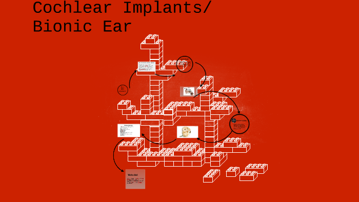 Cochlear Implants/Bionic Ear by Jasena rosales on Prezi