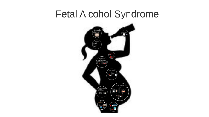 Fetal alcohol syndrom by Ronja Schulz on Prezi