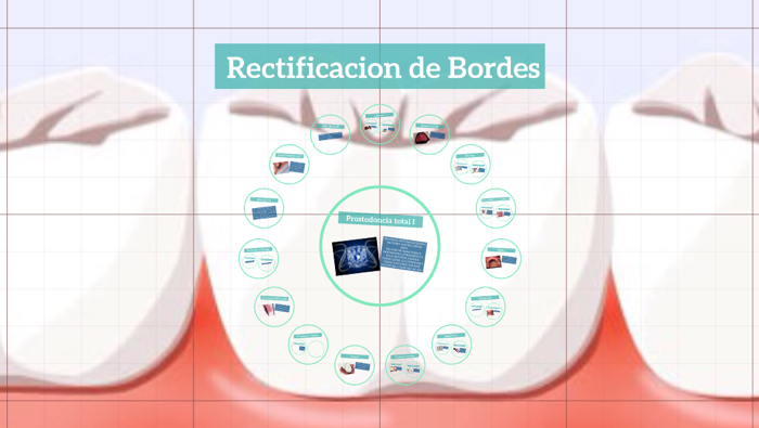 Rectificacion de Bordes by Moni Lemus on Prezi