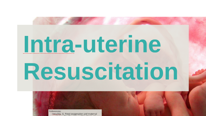 Intrauterine Resuscitation by michelle hawkins on Prezi