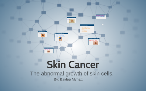 Skin Cancer by Baylee Mynatt on Prezi