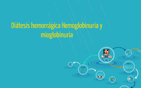 Diátesis hemorrágica by Joseph Ponce on Prezi