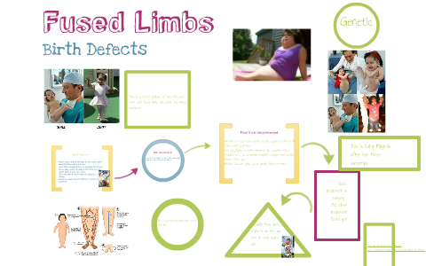 Fused Limbs by Monica Solorzano on Prezi