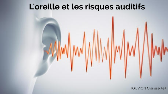 L'oreille et les risques auditifs by Clarisse HOUVION on Prezi