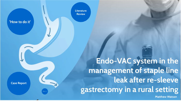 Endo-VAC therapy by Matthew Watson on Prezi
