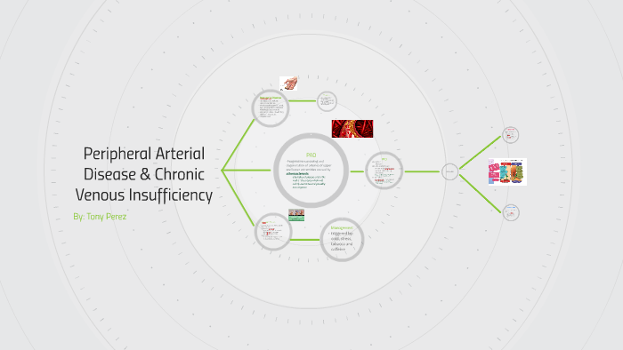 Peripheral Arterial Disease & Chronic Venous Insufficiency by Tony ...
