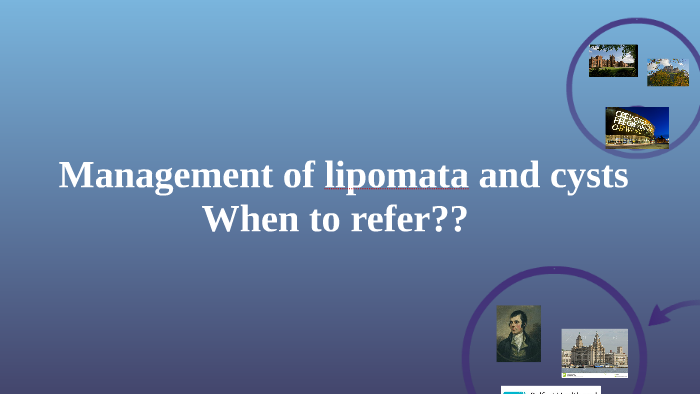 Management of lipoma and cysts by Olga Kerr on Prezi