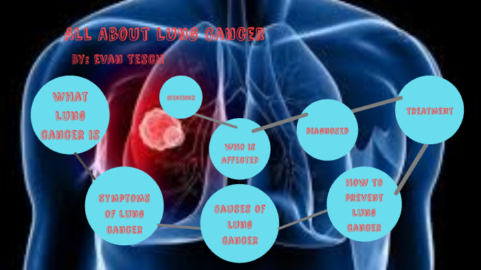 Lung Cancer by Evan Tesch on Prezi