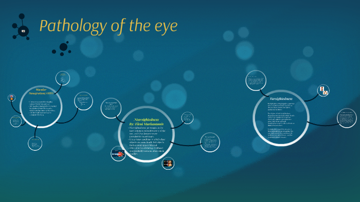 Pathology of the eye by leslie ortega on Prezi