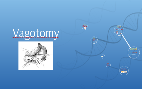 Vagotomy by on Prezi
