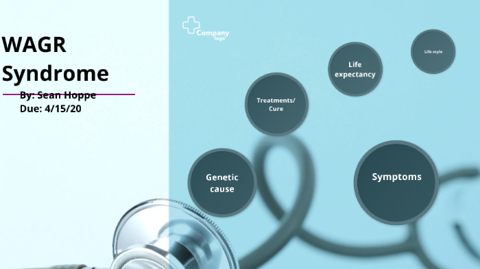 WAGR Syndrome by sean hoppe on Prezi