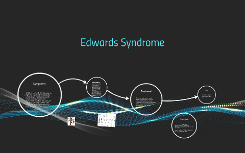 Edwards Syndrome by on Prezi