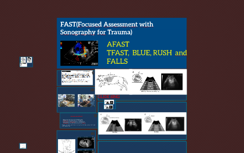 FAST(Focused Assessment with Sonography for Trauma) by Pablo laines