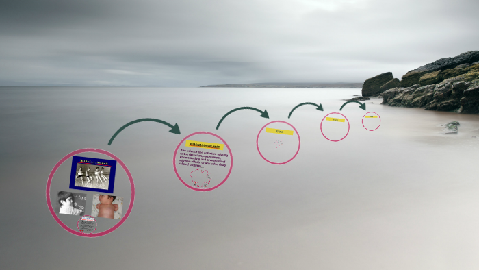 thalidomide induced phocomelia by ghadeer al-kawasimi on Prezi