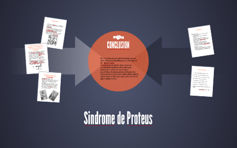 Sindrome de Proteus by Ricardo Ramirez on Prezi