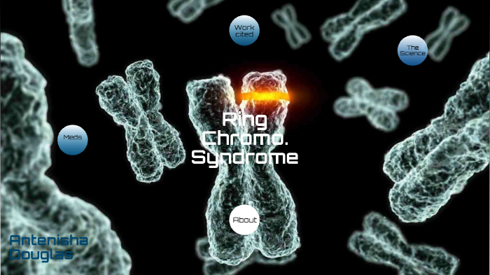 ring syndrome by ANTENISHA DOUGLAS on Prezi