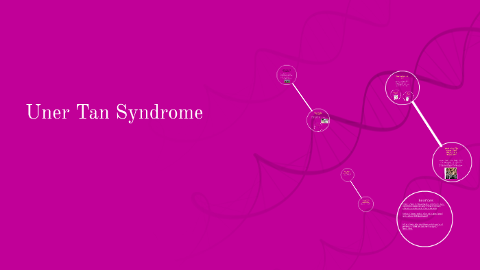 What is Uner Tan Syndrome? by Francisco Sifuentes on Prezi