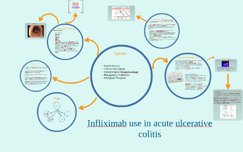 Infliximab use in acute ulcerative colitis by clara treharne on Prezi