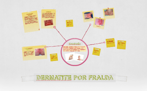 DERMATITE POR FRALDA by Karoline Costa on Prezi