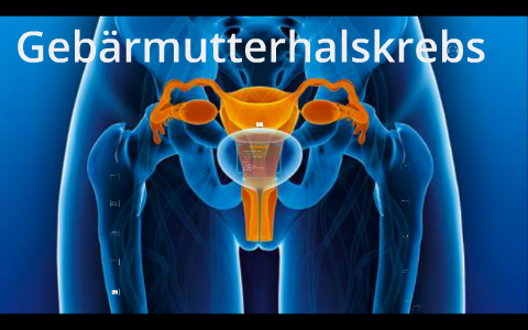 Gebärmutterhalskrebs by Begüm Baysoy on Prezi