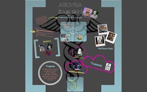 Argyria (blue skin) by McKenzie Lamb on Prezi