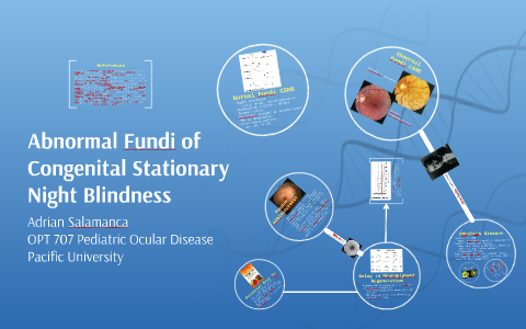 Abnormal Fundi of Congenital Stationary Night Blindness by on Prezi
