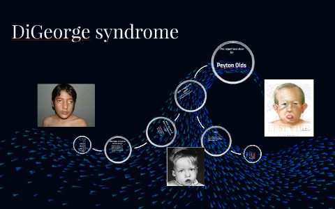 DiGeorge syndrome by Peyton Olds on Prezi