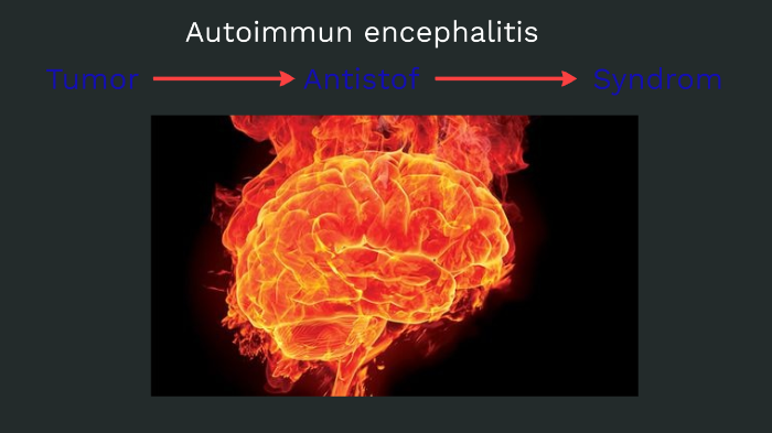 Autoimmun encephaliitis by Jesper Ratzer on Prezi