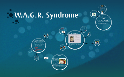 W.A.G.R. Syndrome by Megan Palacio on Prezi