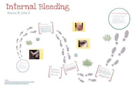 Internal Bleeding by julieandemma people on Prezi
