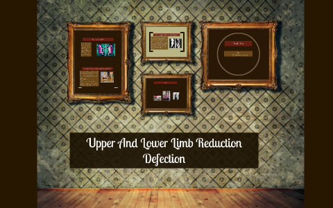 Upper And Lower Limb Reduction Defection by Christy Reynoso on Prezi