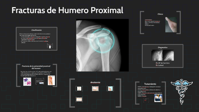 Fracturas de Humero Proximal by itzel Hernandez on Prezi