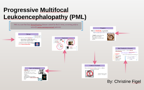Progressive Multifocal Leukoencephalopathy (PML) by Chrissy Figel on Prezi