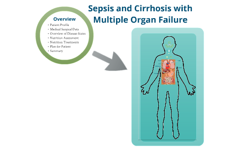 Sepsis and Cirrhosis with Multiple Organ Failure by Dana Kent on Prezi