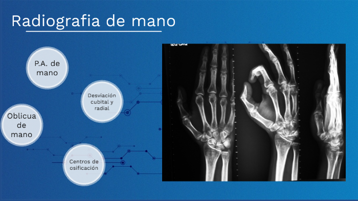 RADIOGRAFIA MANO by Jemmilee Salinas on Prezi